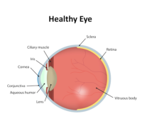Corneal Ulcers - Memorial Eye Institute