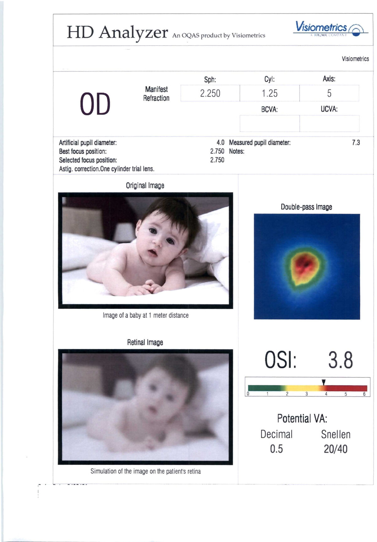 Tests & Diagnostics - Memorial Eye Institute - LASIK Harrisburg