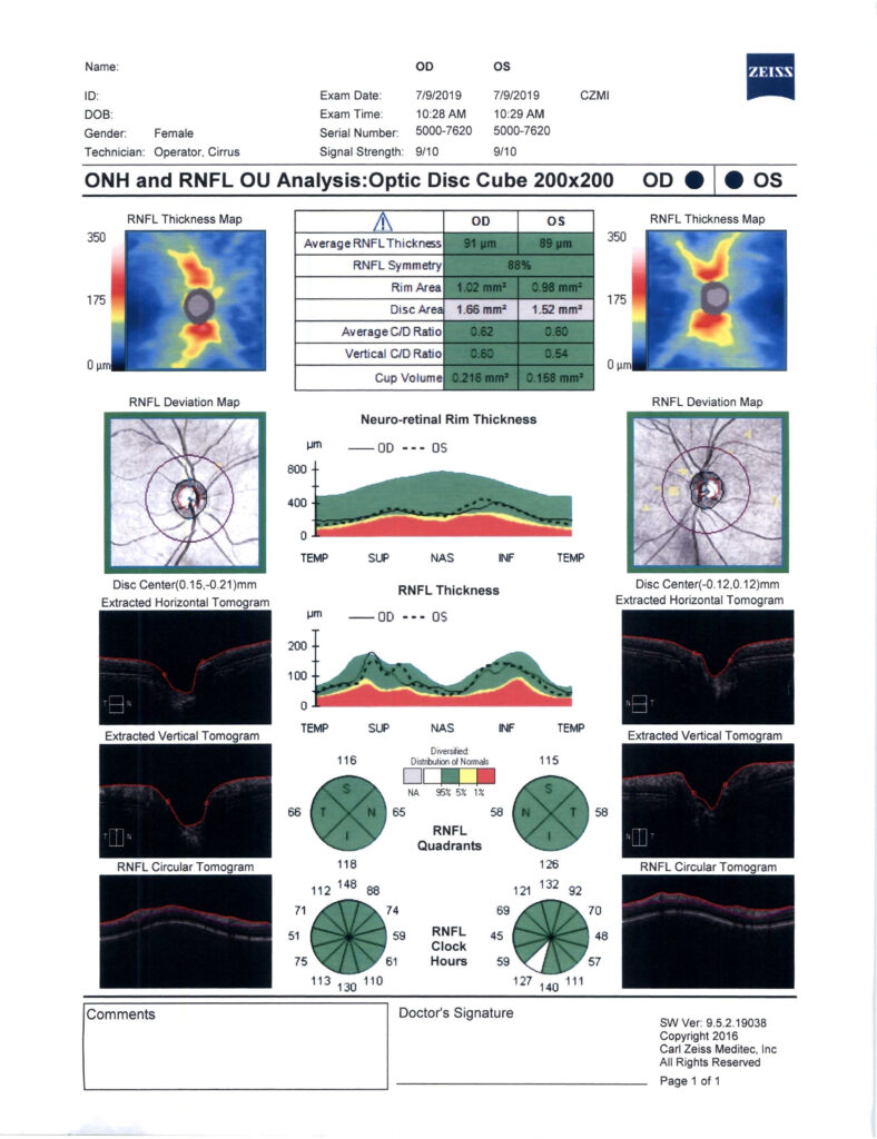 Tests & Diagnostics - Memorial Eye Institute - LASIK Harrisburg