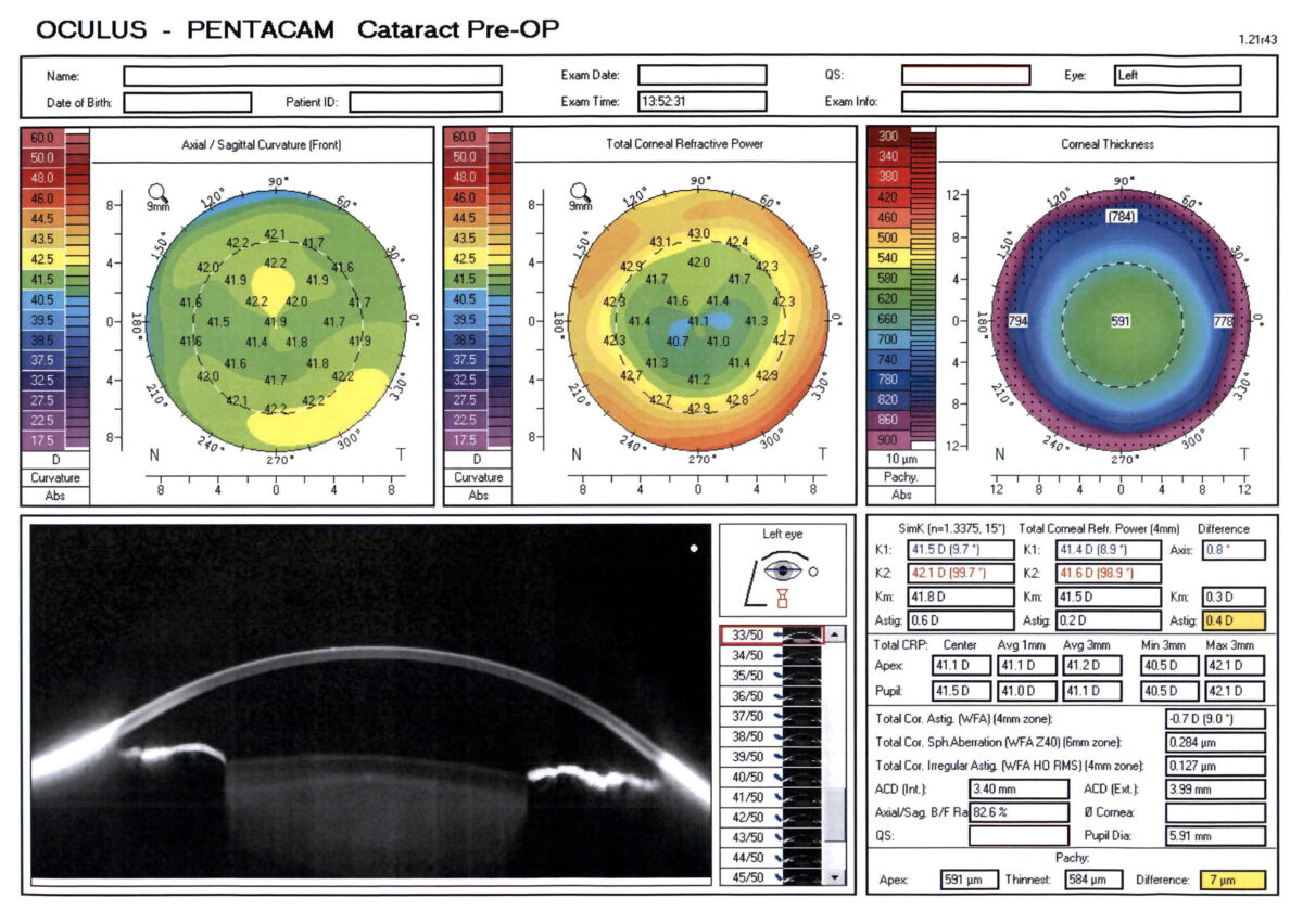 Tests & Diagnostics - Memorial Eye Institute - LASIK Harrisburg