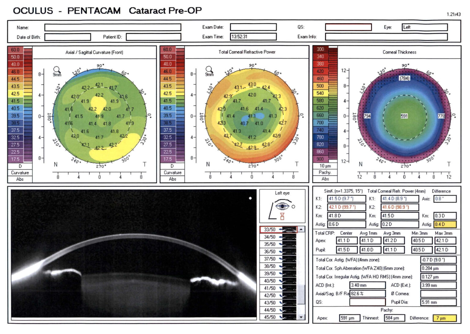 Tests & Diagnostics - Memorial Eye Institute - LASIK Harrisburg