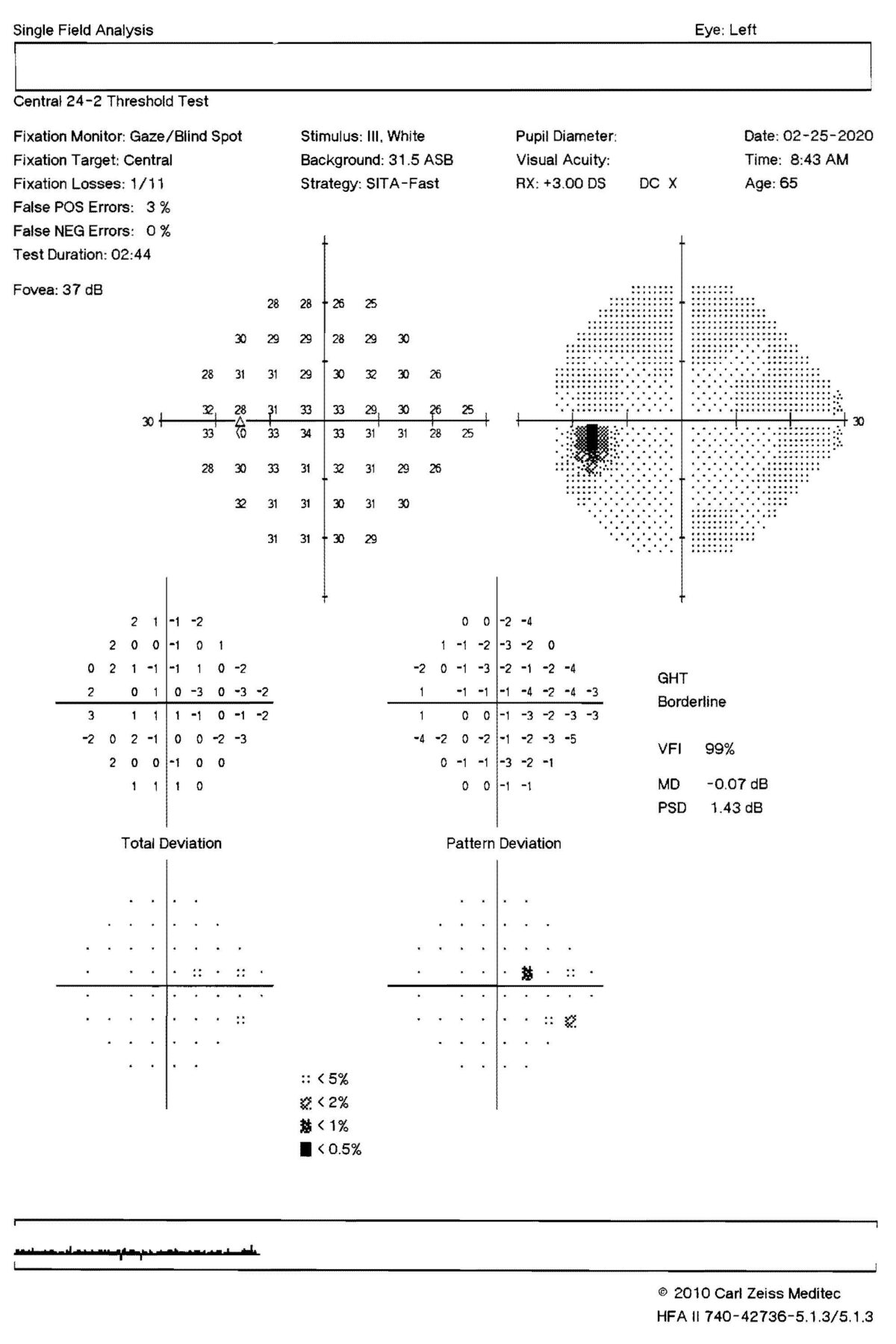 Tests & Diagnostics - Memorial Eye Institute - LASIK Harrisburg